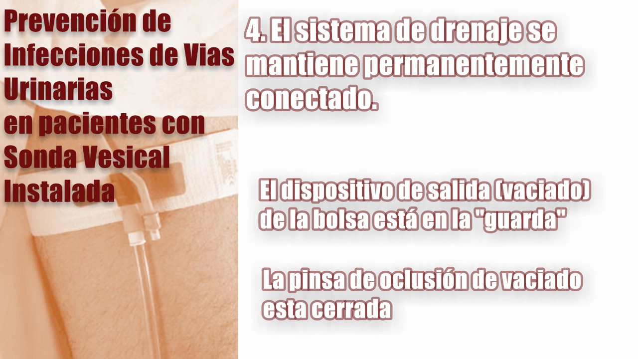 Prevención de IVU en P. con Sonda Vesical - YouTube