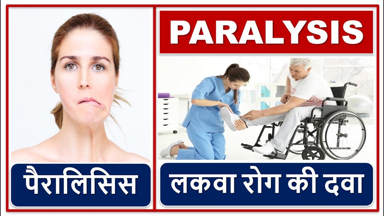 पैरालिसिस, लकवा रोग की दवा, पैरालिसिस क्यों होता है?, PARALYSIS, CAUSES ...