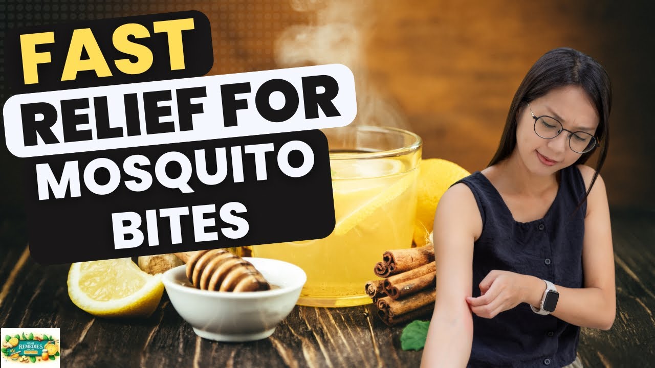 Get Fast Relief from Mosquito Bite Itch | Top Home Remedies to Soothe ...
