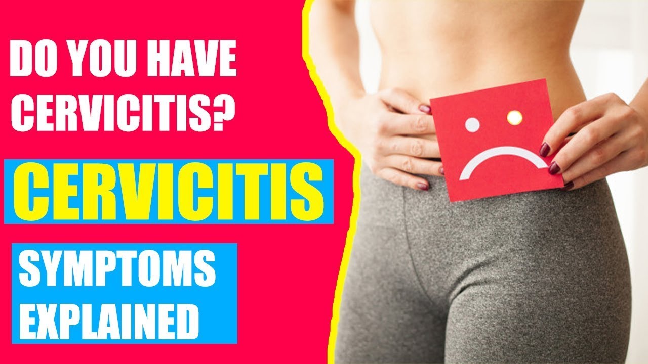 CERVICITIS SYMPTOMS | IS CERVICITIS CURABLE? | CURE91 - YouTube