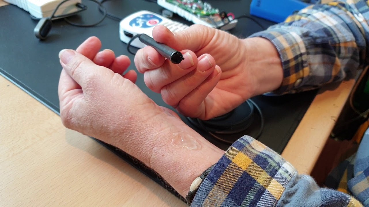 Pencil Probe with the CAT+ Doppler - perfect for Exotic Monitoring ...
