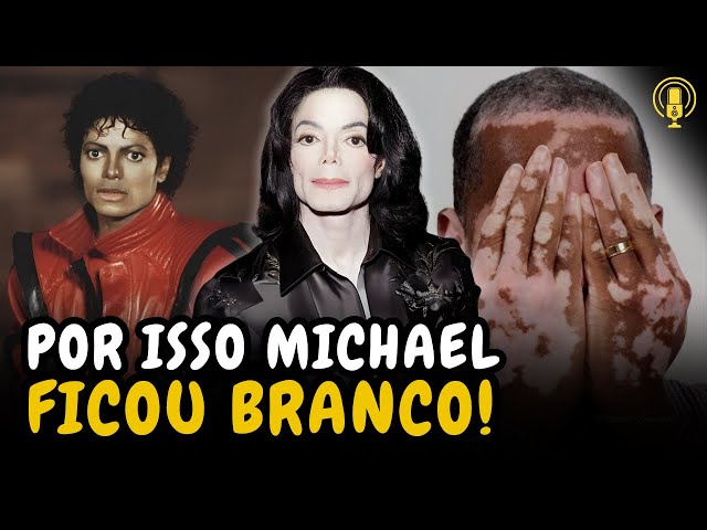 Como Michael Jackson Ficou Branco Michael Jackson | Por Que A Pele De