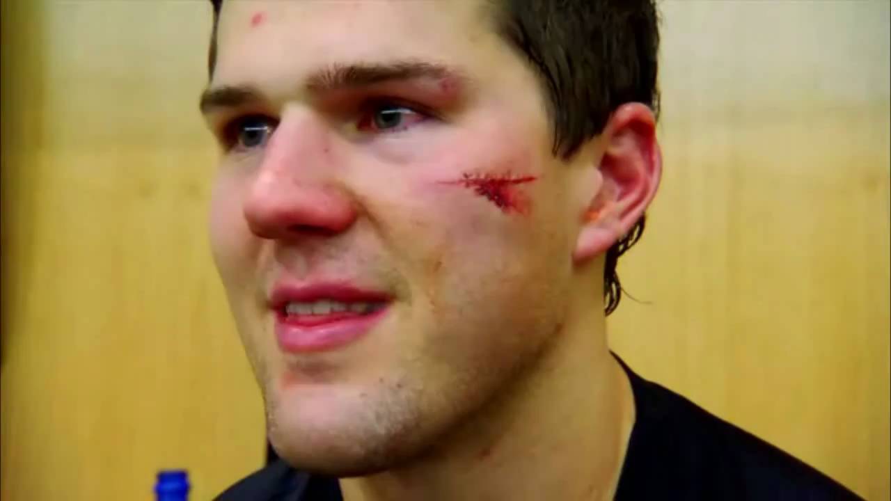 Ben Lovejoy takes a puck to face (Pittsburgh Penguins) - YouTube