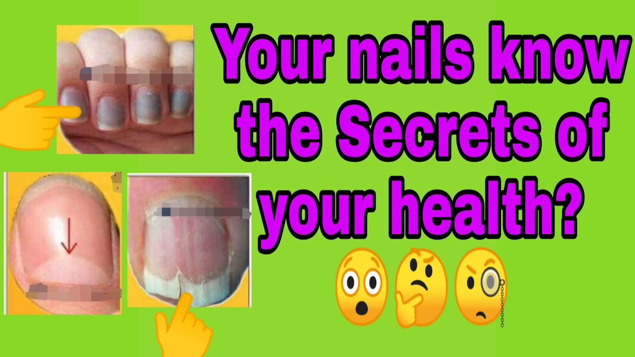 5 Things Your Nails Can Tell You About Your Health - YouTube
