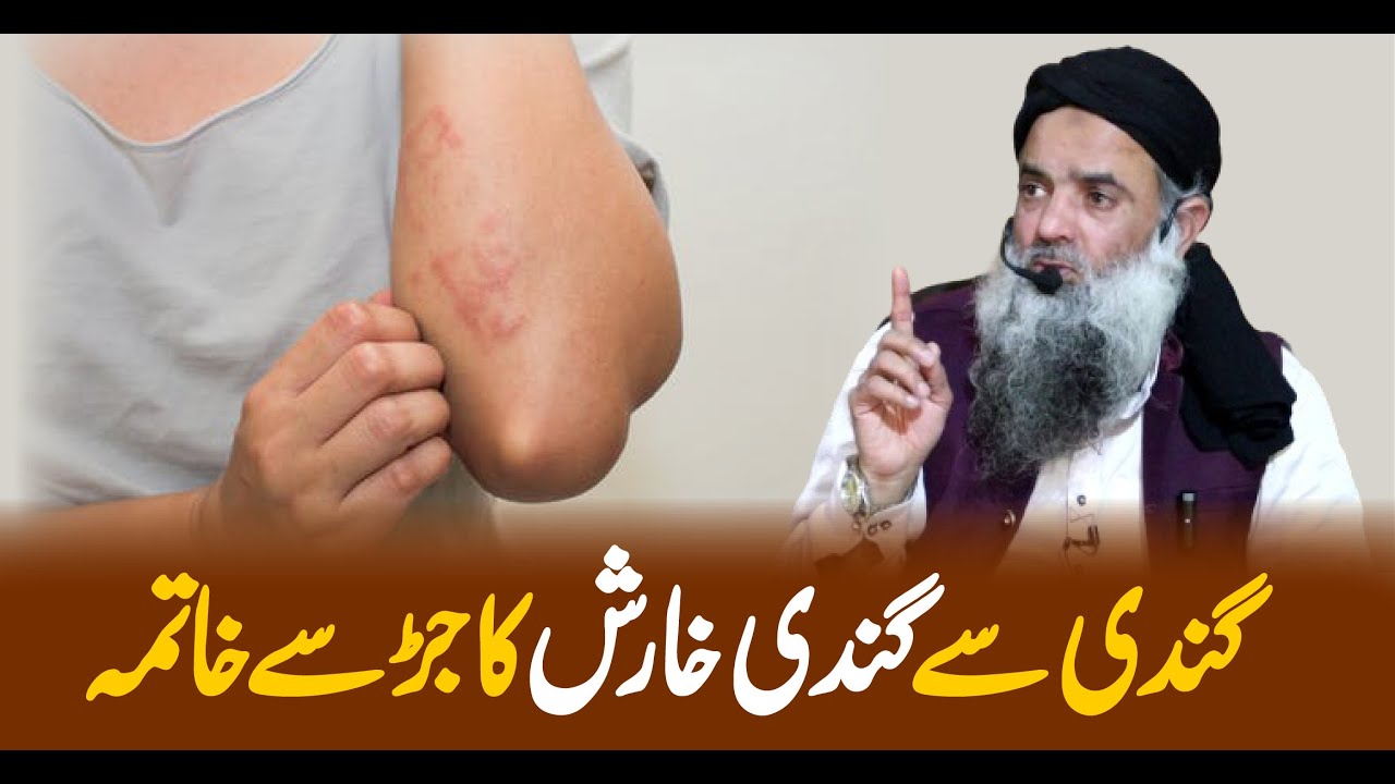KHarish KA Fori Ilaj | KHarish KA GHarelo ILaj | KHarish KA Ilaj By Dr ...