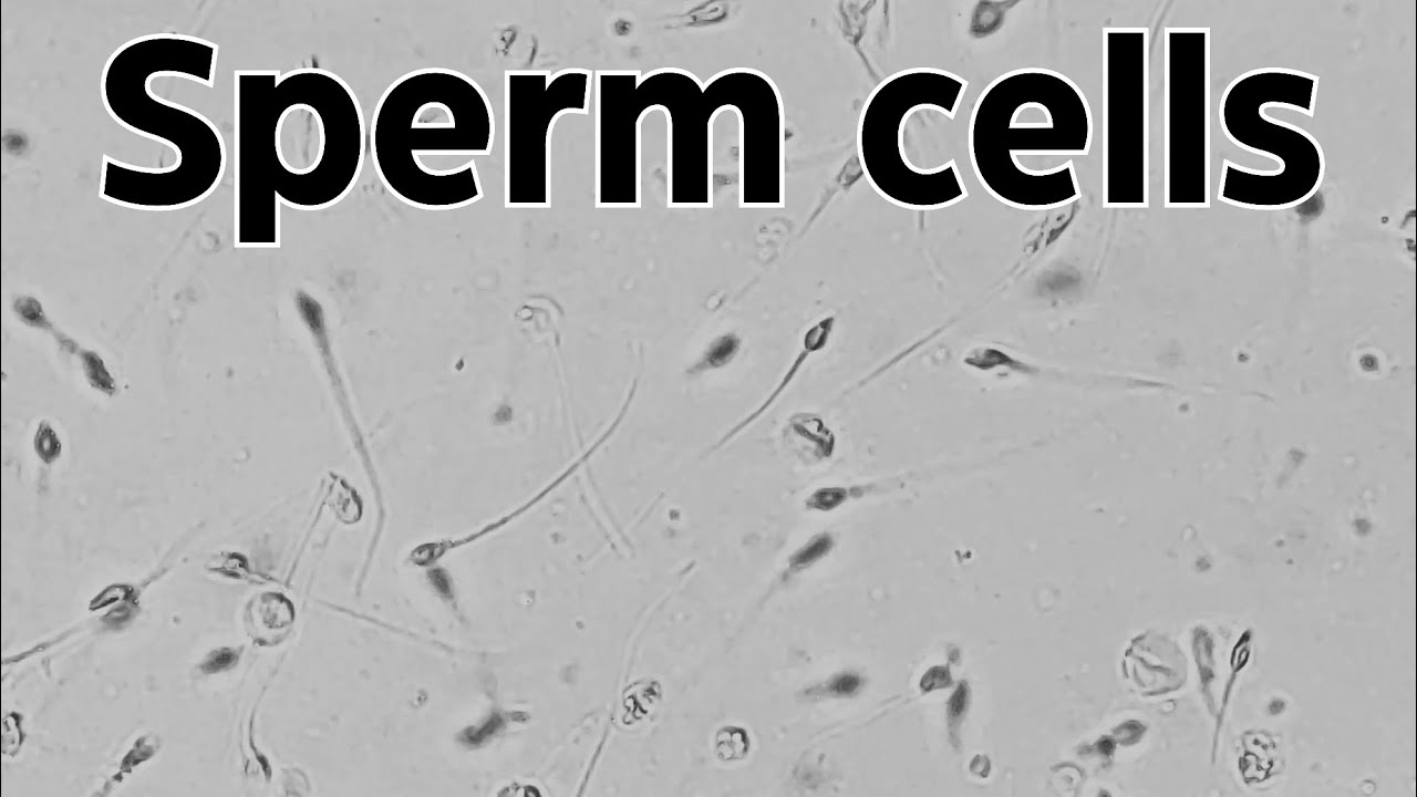 Sperm Cells Under Microscope 🔬 Youtube 8519