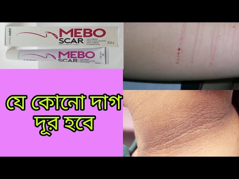 Mebo scarযেকোনো দাগ দূর হবে দুবাইয়ের বিখ্যাত মেবো এসকার ক্রীম।