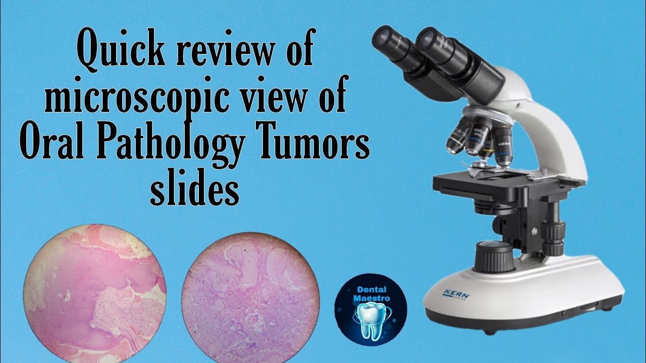 Quick review of the microscopic view of the oral pathology tumors ...
