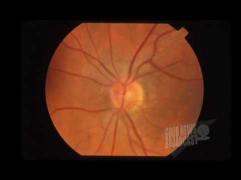 Dr. Robert Ritch, MD - YouTube