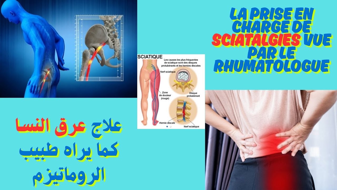 Prise en charge des sciatalgies par le traumatologue : diagnostic et ...