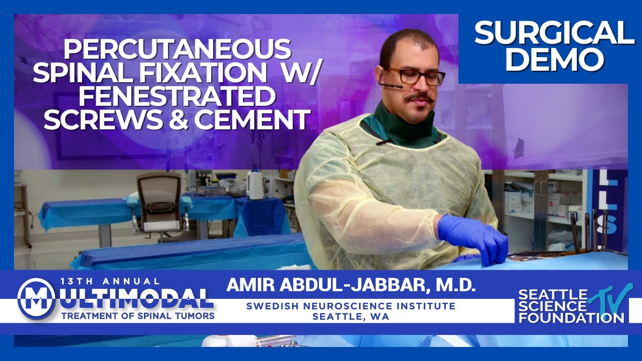 Percutaneous Spinal Fixation with Fenestrated Screws with Cement - Amir ...