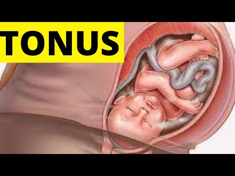 Hamiləlikdə Tonus Uşağı Salırmı? - HAMİLƏLƏR DİQQƏT!