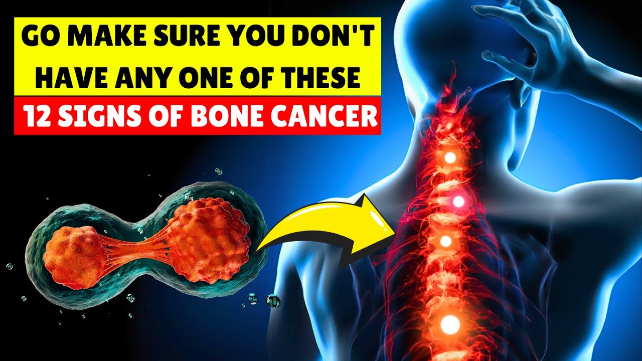 12 SHOCKING Signs Of Bone Cancer Nobody Talks About - YouTube