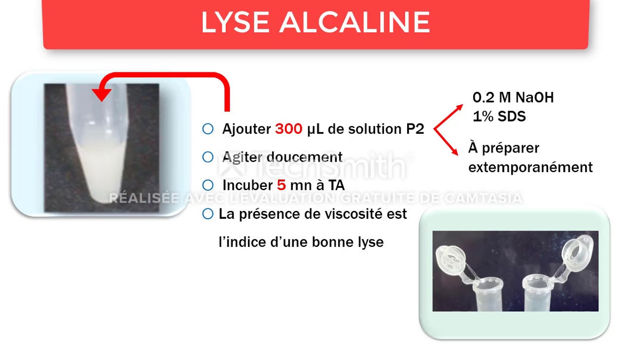 Protocole d'extraction de l'ADN plasmidique - YouTube