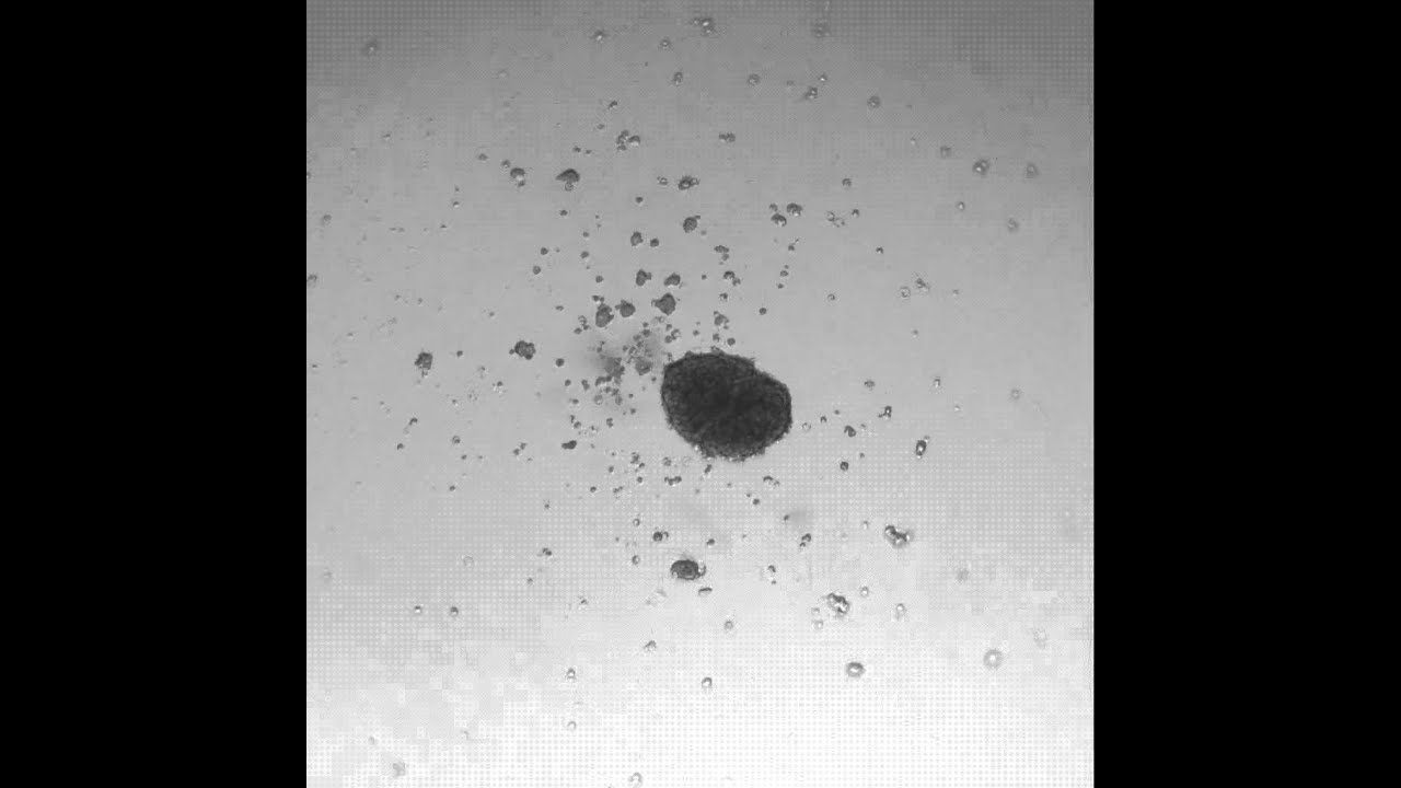 3D Spheroid Formation of MSC - YouTube