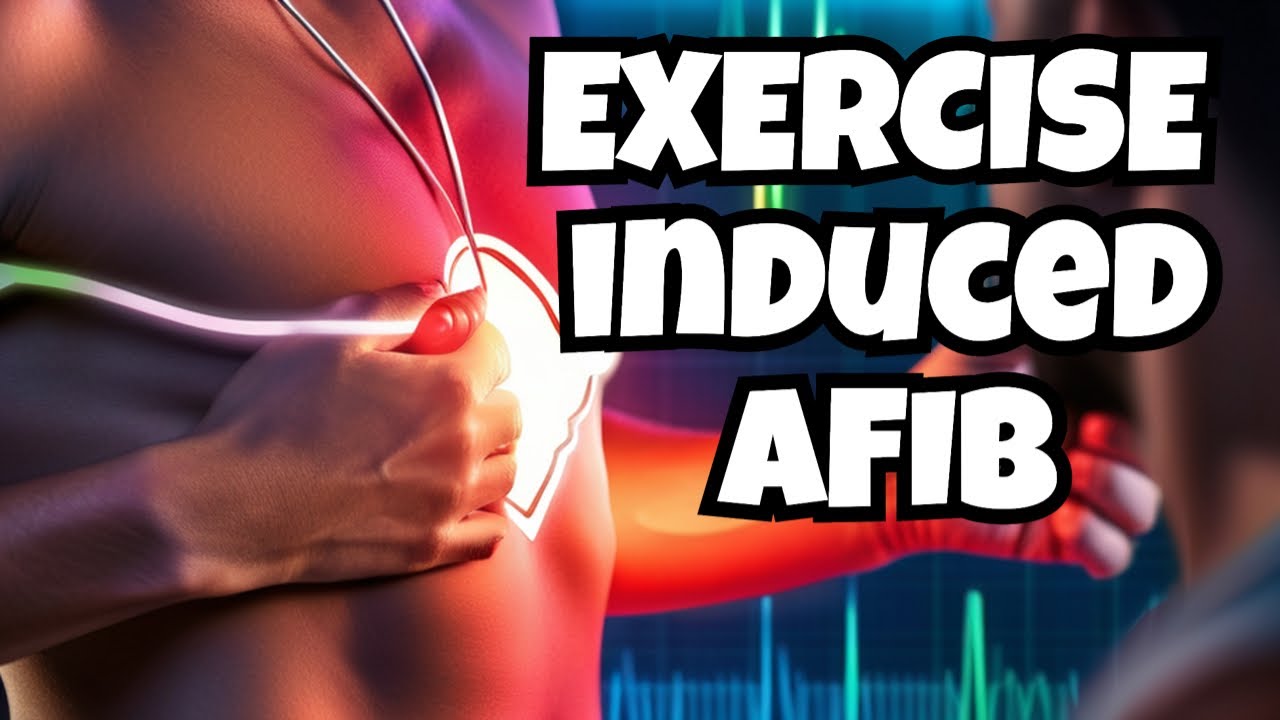 Exercise Induced AFib: Expert Tips - YouTube