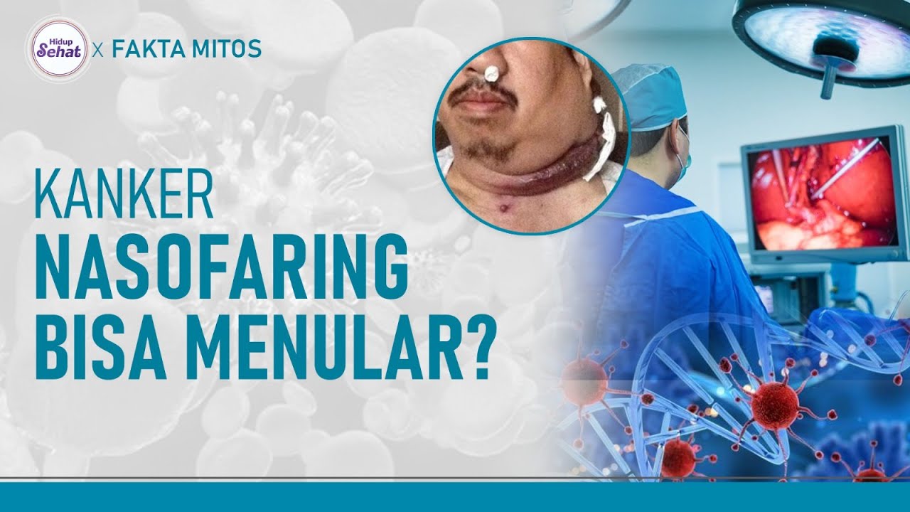 Kanker Nasofaring Bisa Menular, Mitos atau Fakta? | Hidup Sehat tvOne ...