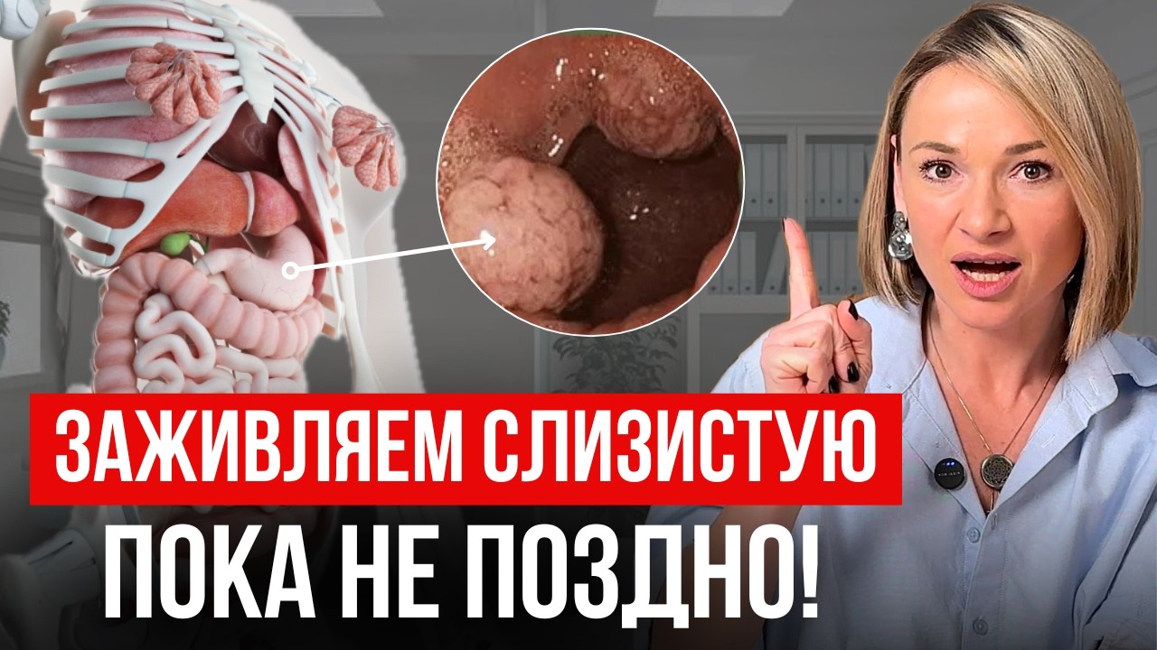 Самые БЫСТРЫЕ способы заживления ЖКТ без таблеток ГАСТРИТ ЯЗВА