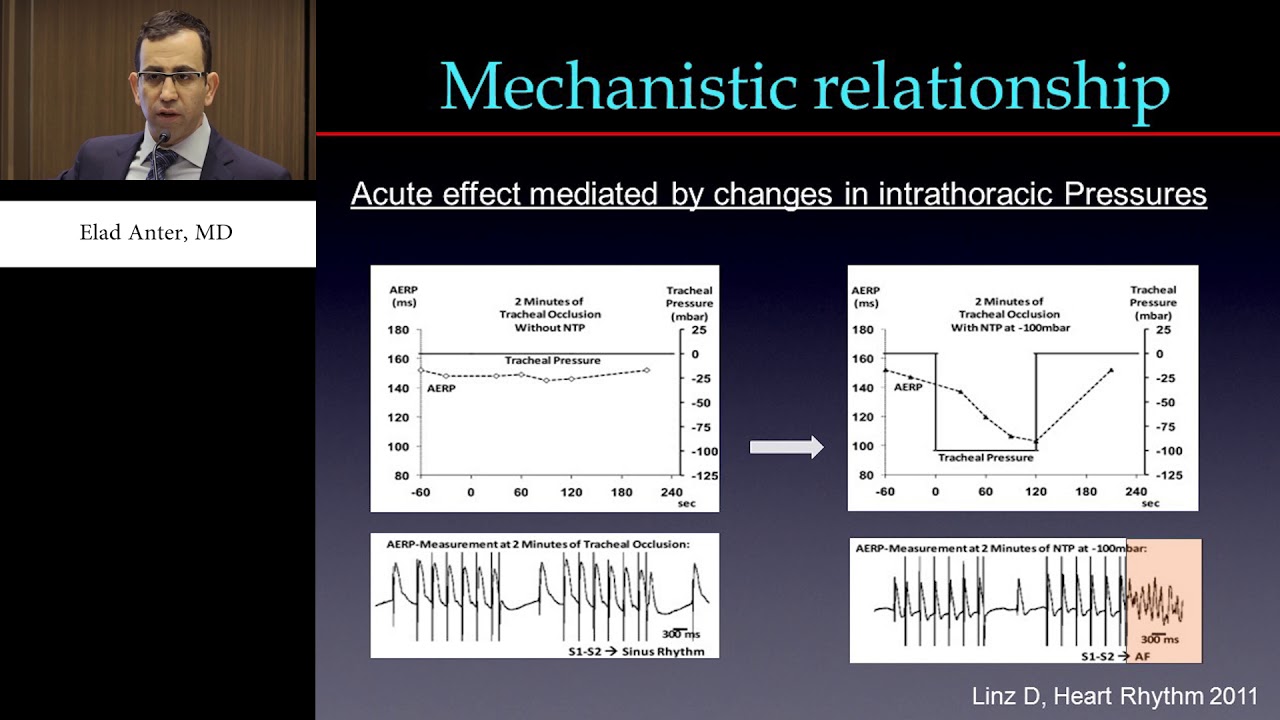 Itamar Panel Symposium HRS 2016 ELAD ANTER - YouTube