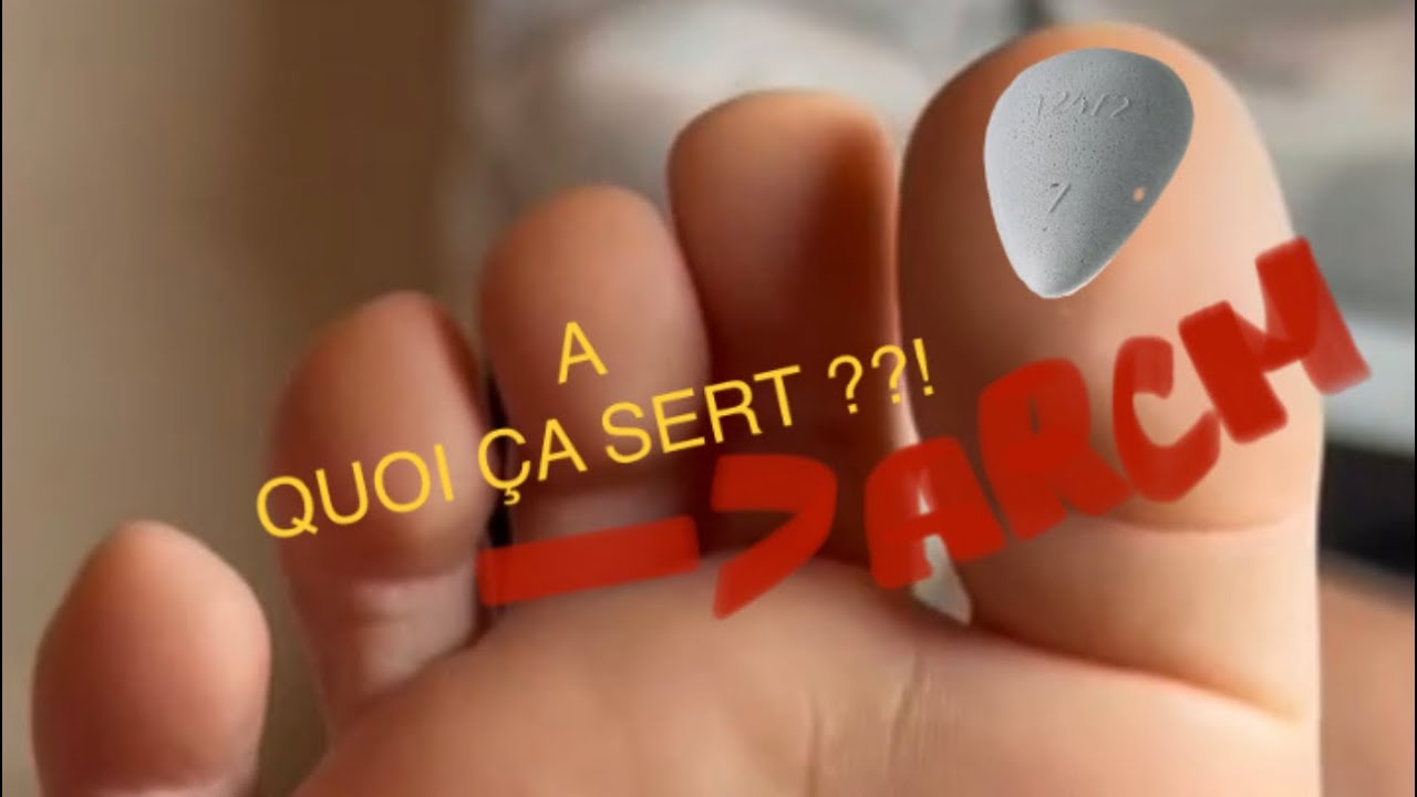 ARCM, appui-rétro capital médian, élément de semelle, podologie - YouTube