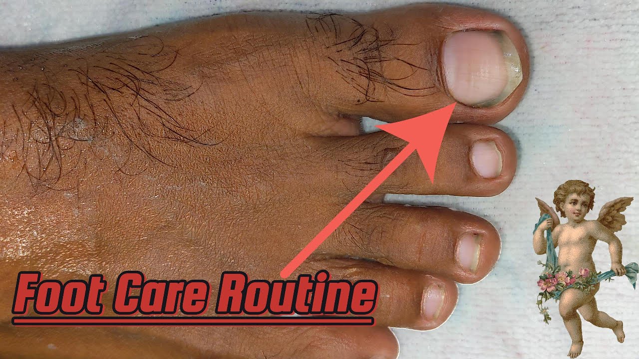 🦶Toenail Transformation! | From Rough to Clean 💅 | Satisfying Foot Care ...