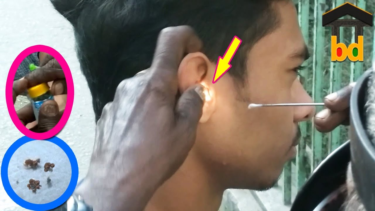 Teenager Ear Cleaning for 1st Time at Roadside ASMR II Ear Picking with ...