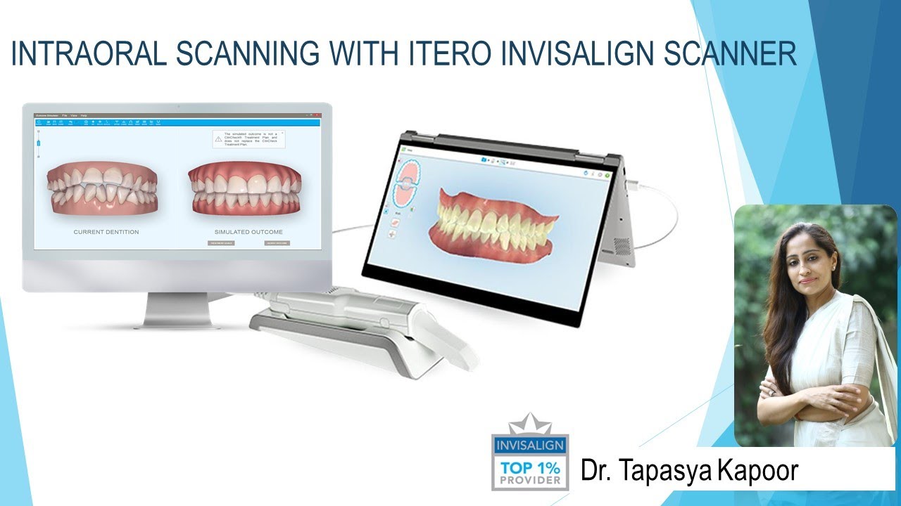 Intraoral Scanning with iTero 3D Invisalign Scanner - YouTube