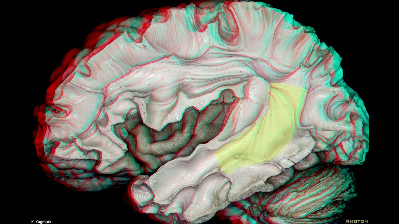 Fiber Pathways of the Cerebrum (3D Anaglyph) - YouTube