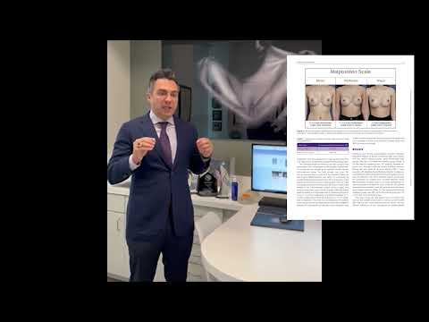 Durasorb Mesh Internal Bra for Breast Augmentation in Newport Beach, CA