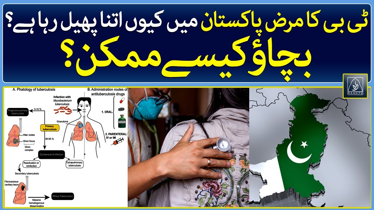 Why is TB Spreading so Fast in Pakistan? - How to Protect Ourselves ...