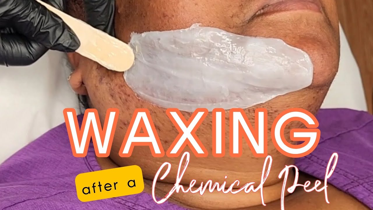 WAXING AFTER A CHEMICAL PEEL! - YouTube
