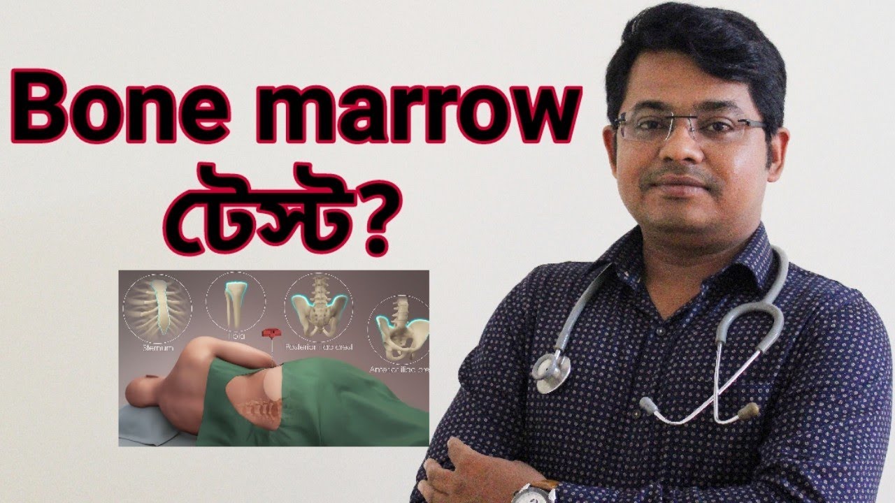 Bone marrow examination(অস্থিমজ্জা পরীক্ষা )/Vlog29/#Doctoronyoutube ...
