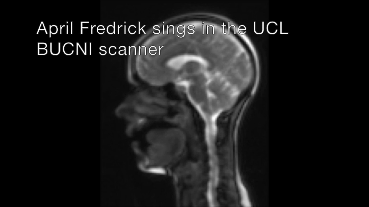 April Fredrick singing in the BUCNI scanner - dynamic MRI - YouTube