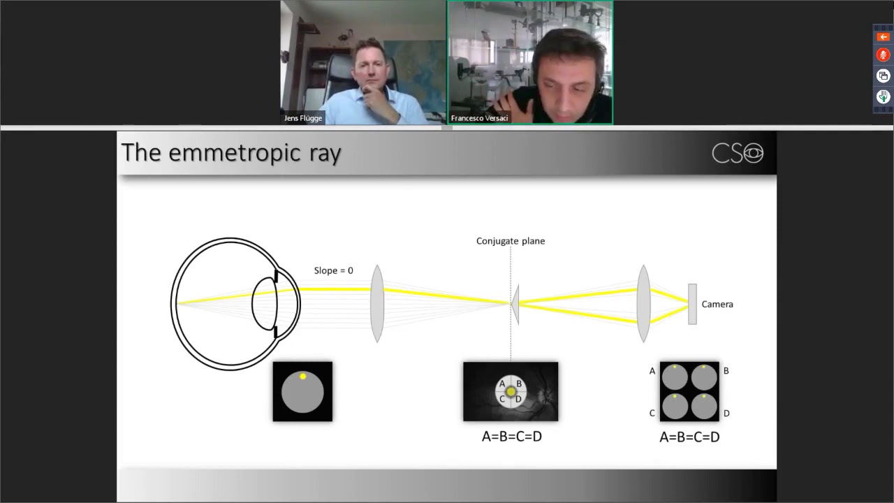 SCHWIND Peramis Principles and Applications Webinar Recording of 14 May ...