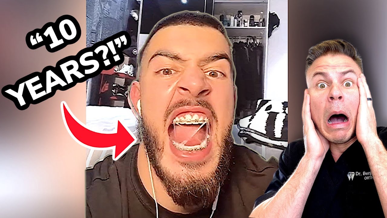 What Having Braces For 10 Years Does To Your Teeth | The Bentist Reacts ...