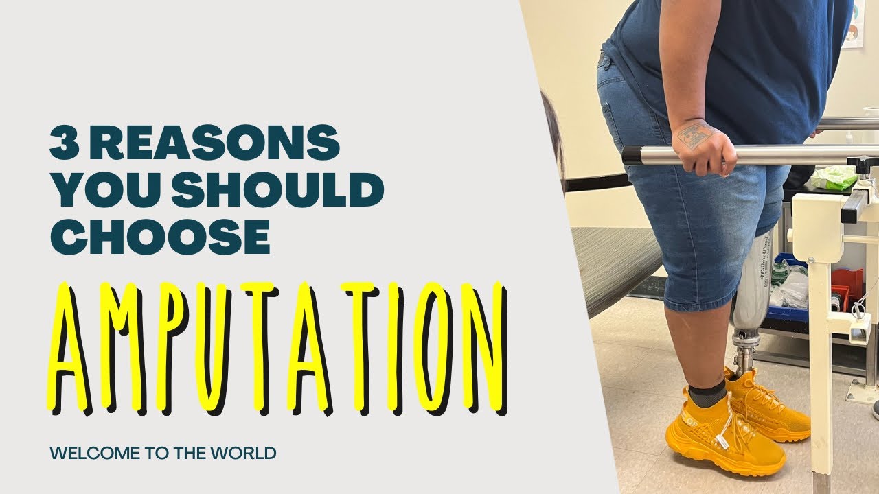 Celebrate 1 Year Amputee Living | 3 Reasons You Should Choose ...