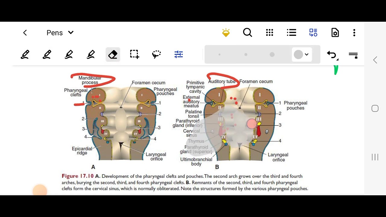 Pharyngeal (Branchial) Arches- Human anatomy I الأقواس البلعومية ...