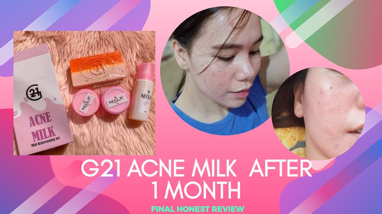 G21 Acne Milk Rejuv Set |First time user|Before After Review - YouTube