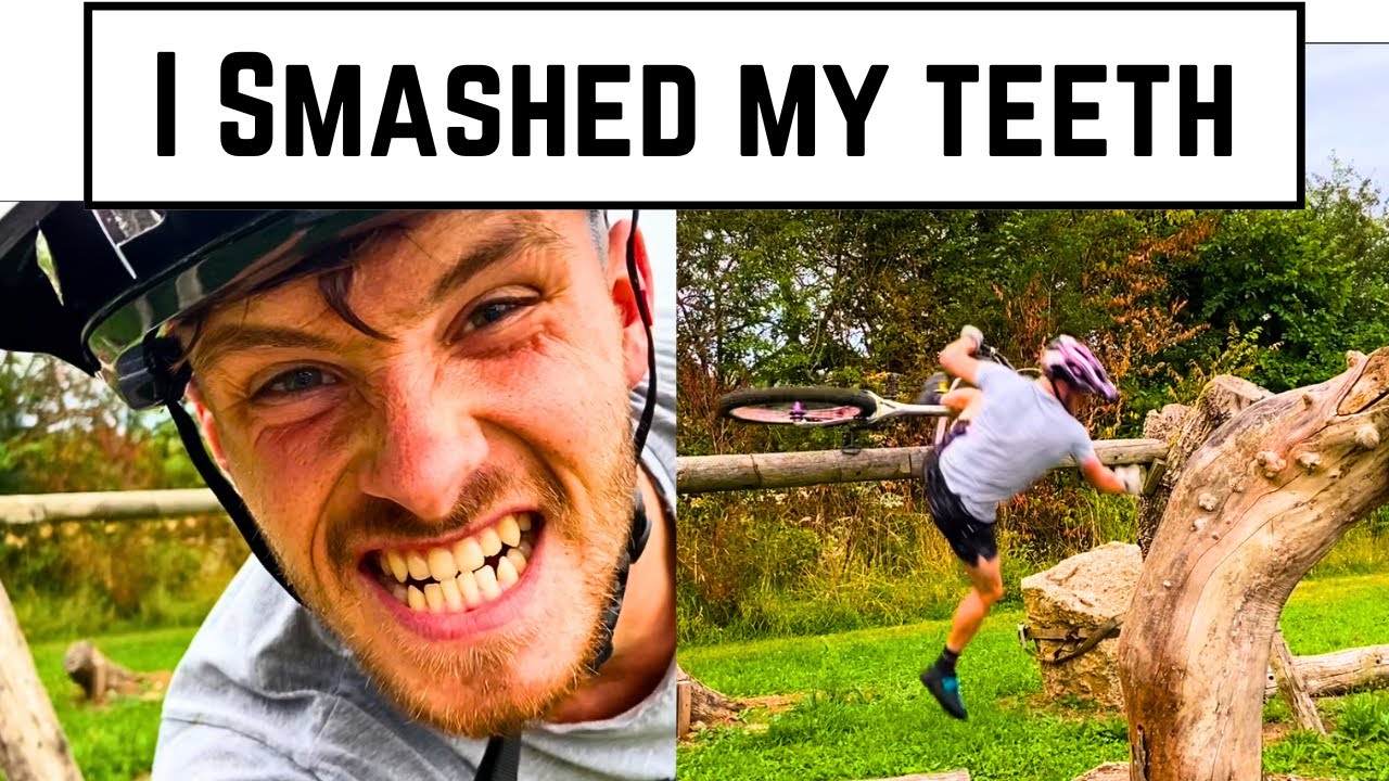 I smashed my face - YouTube