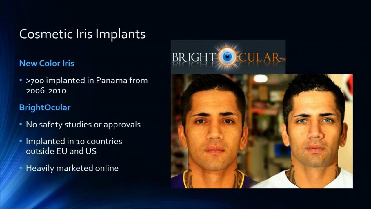 Never Do Brightocular - The Reality of Brightocular & NewColorIris ...