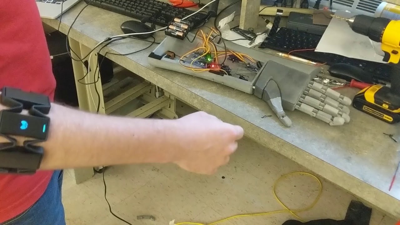 REACH (Robotic Enhanced Amputee Controlled Hand) Overview - YouTube