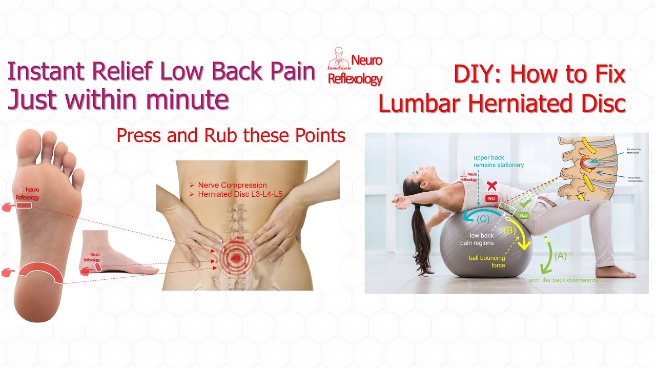 Low Back Pain: Instant Relief Powerful Method #sciatica #lowbackpain #shorts #reflexes #reels # ...