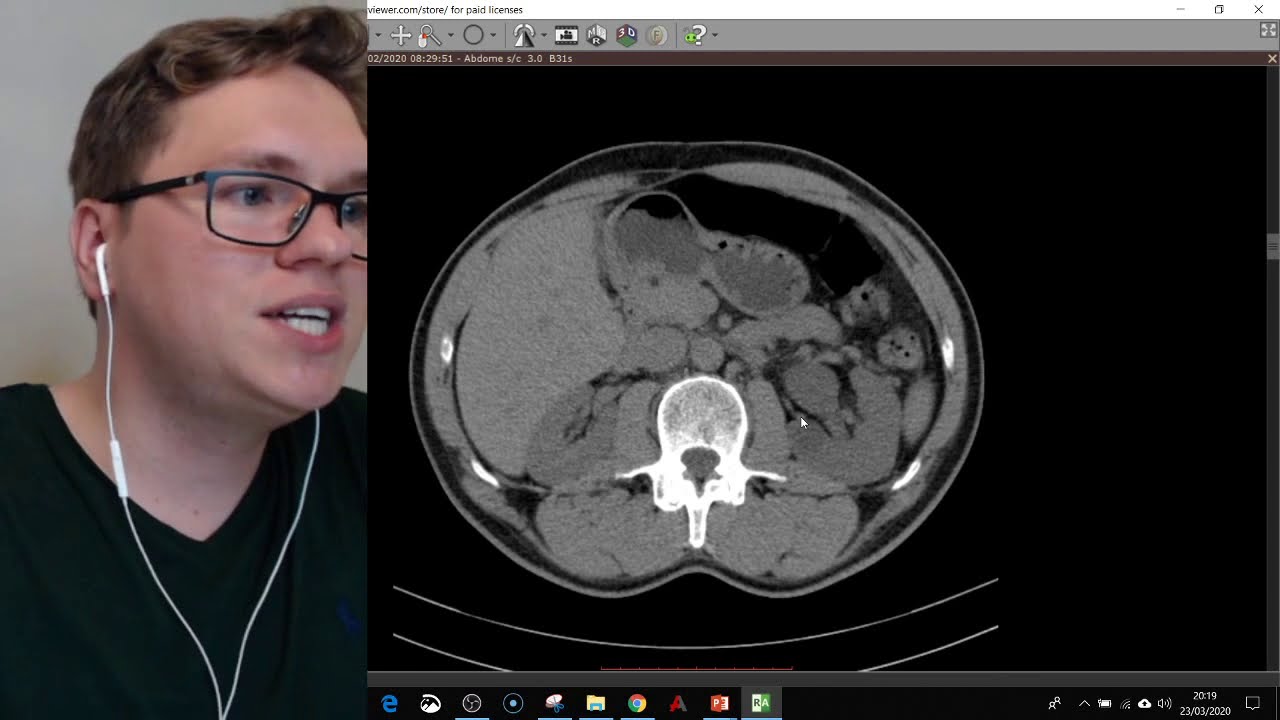 AVALIAÇÃO POR IMAGEM DAS PATOLOGIAS DO ABDOME - Tomografia do Abdome e ...