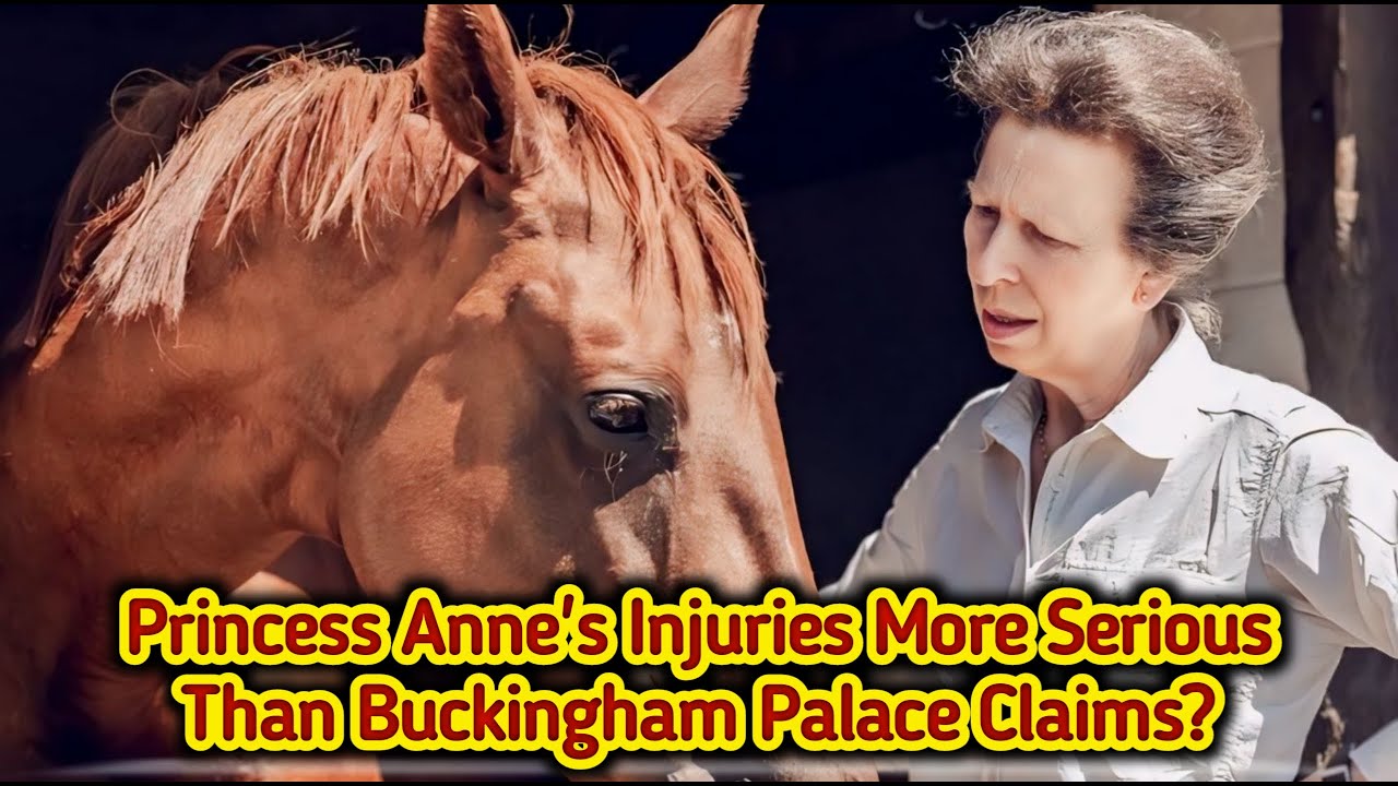 Princess Anne's Injuries: More Serious Than Buckingham Palace Claims ...