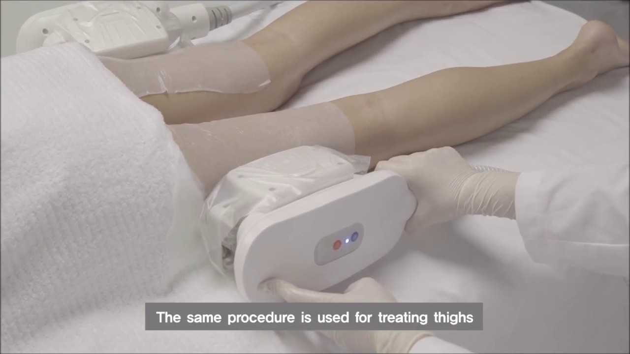 MiCool-A Fat Freezing Cryo Fat Reduction Device - YouTube