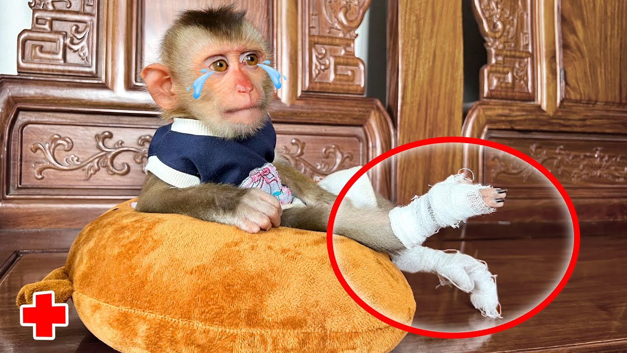Is Dad's method of treating burns effective - YouTube