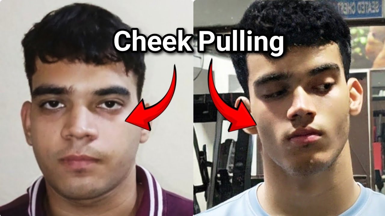 How To Do Cheek Pulling (Cheekpulling in Hindi Guide) - YouTube
