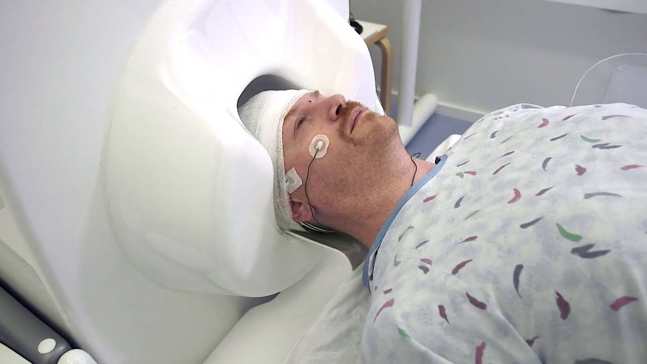 Neurosciences - Epilepsy - MEG - YouTube