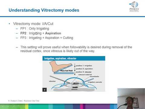 Understanding the Principles of Anterior Vitrectomy - YouTube