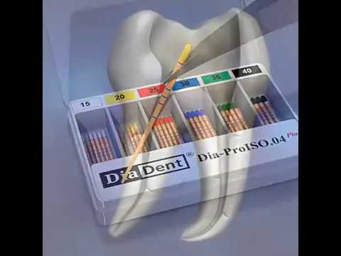 Obturation Of Root Canals Step by Step MyDentCart | Video of obturation ...